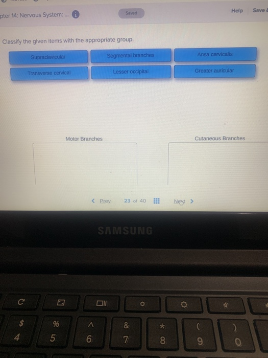 Solved pter 14: Nervous System: 0 Sved Help Save Classify | Chegg.com