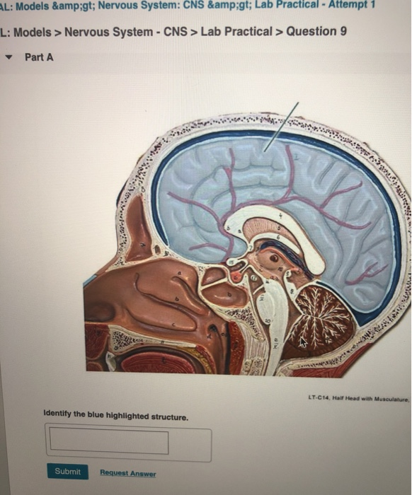 Solved AL: Models > Nervous System: CNS > Lab Practical - | Chegg.com Solved AL: Models > Nervous System: CNS > Lab Practical - | Chegg.com