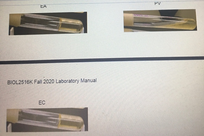 Solved Urease results: PA- Pseudomonas aeruginosa; | Chegg.com