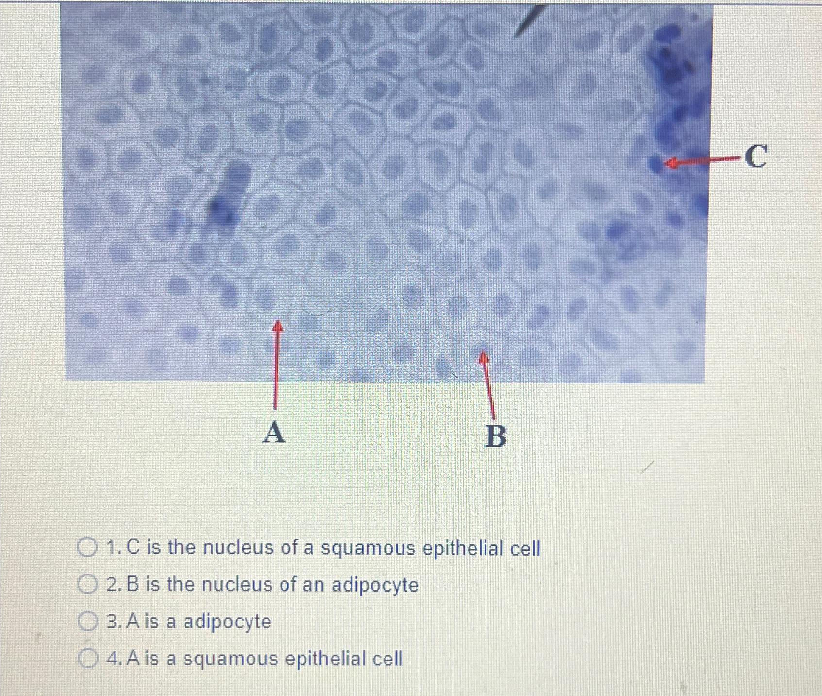 Solved C is the nucleus of a squamous epithelial cellB ﻿is | Chegg.com
