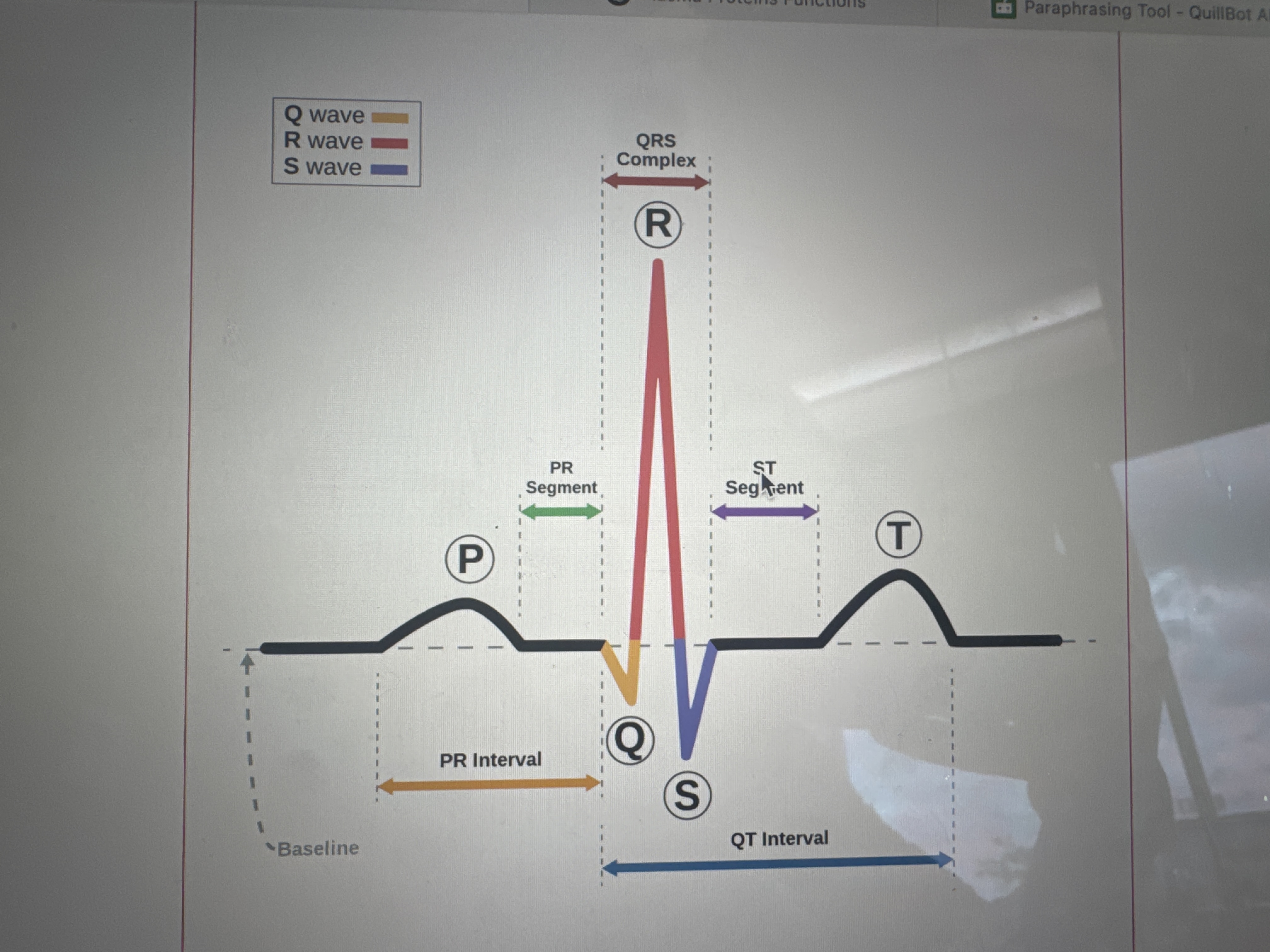 Solved The sequence of depolarization and depolarization of | Chegg.com