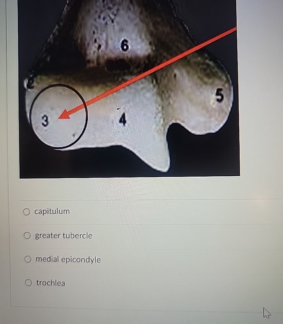 Solved capitulumgreater tuberclemedial epicondyle ﻿trochlea | Chegg.com