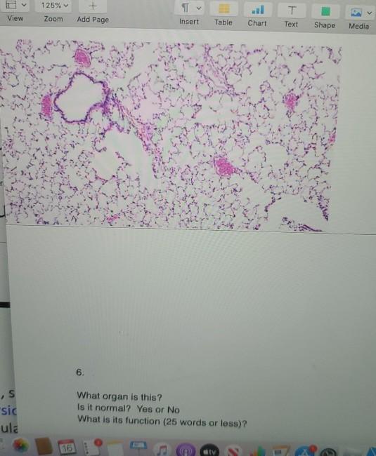 Solved V 125% T T View Zoom Add Page Insert Table Chart Text | Chegg.com