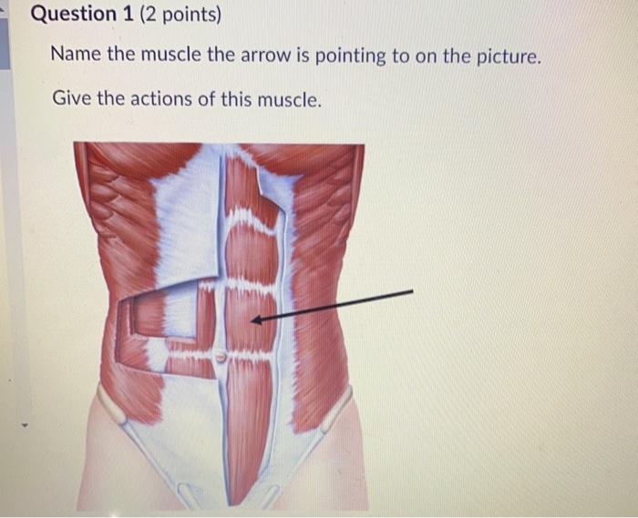 Solved Question 1 (2 points) Name the muscle the arrow is | Chegg.com