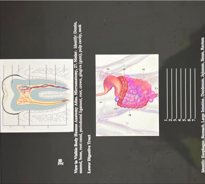 Solved label | Chegg.com