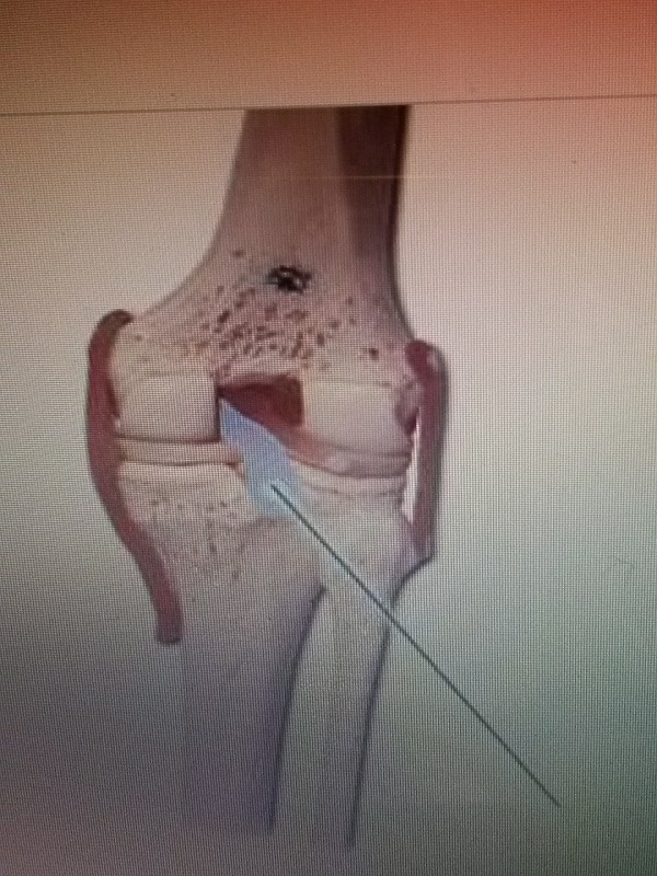 Solved session.masteringaandp.com/ UNG App Plugins 5 New | Chegg.com