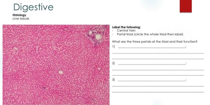 Solved Digestive Histology Liver lobule Label the following: | Chegg.com