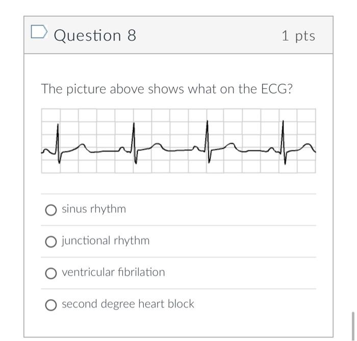 Solved Question 8 The picture above shows what on the ECG? | Chegg.com