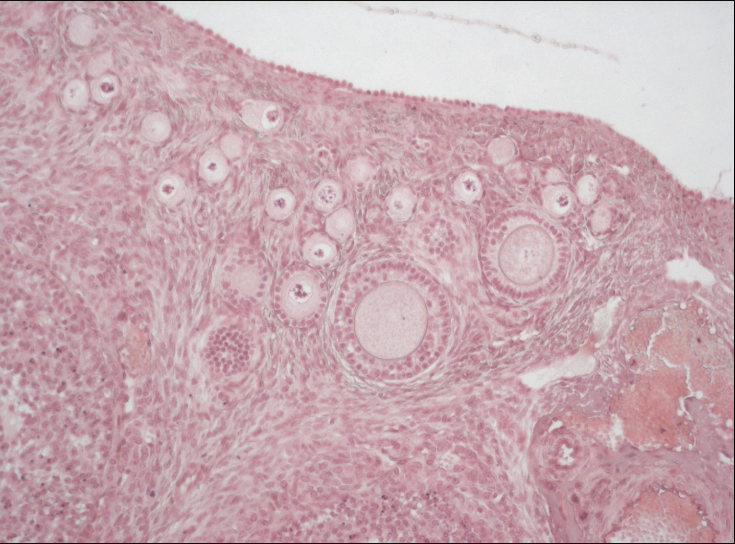 [Solved]: Rabbit ovary (cross section; staining: hematoxylin