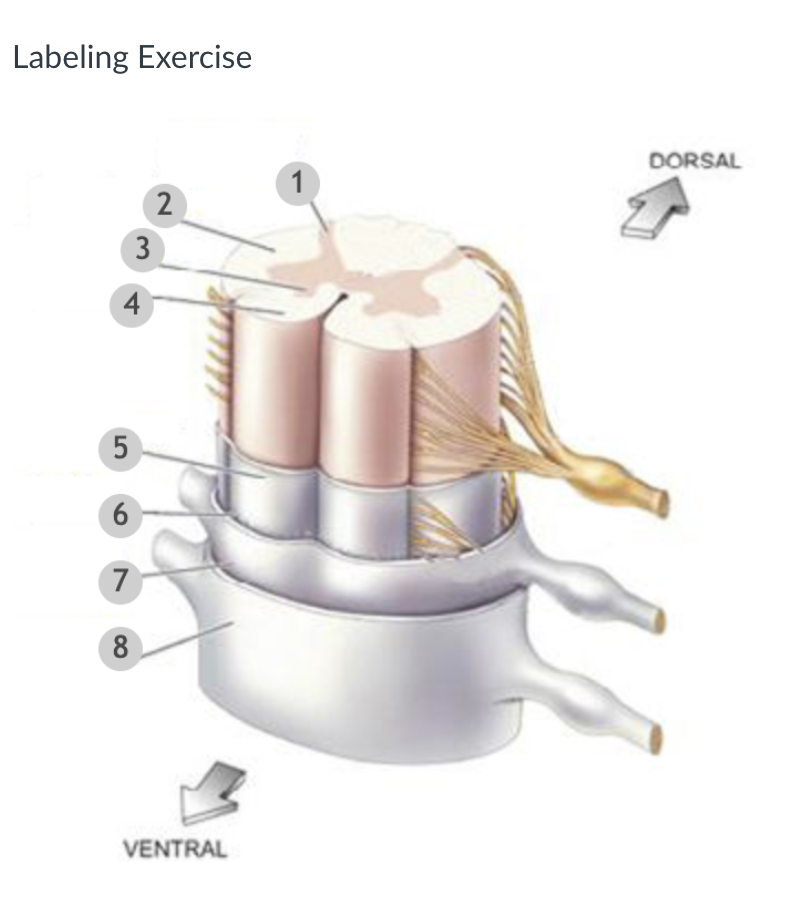 Solved Labeling Exercise - ﻿Options: Ventral horn, Ventral | Chegg.com