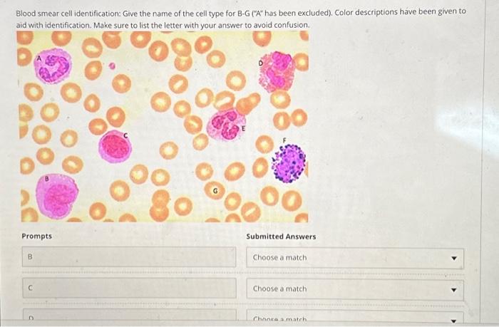 Solved Blood smear cell identification: Give the name of the | Chegg.com
