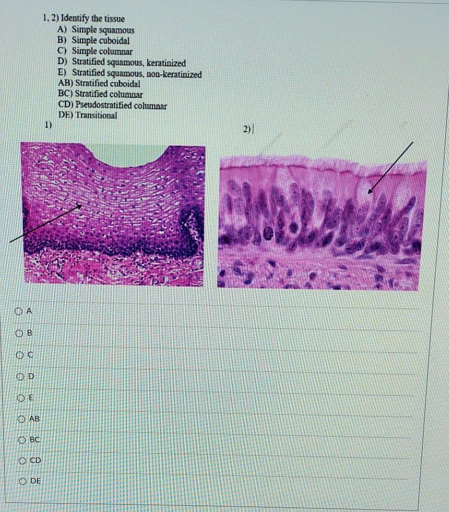 Solved 1, 2) Identify the tissue A) Simple squamous B) | Chegg.com
