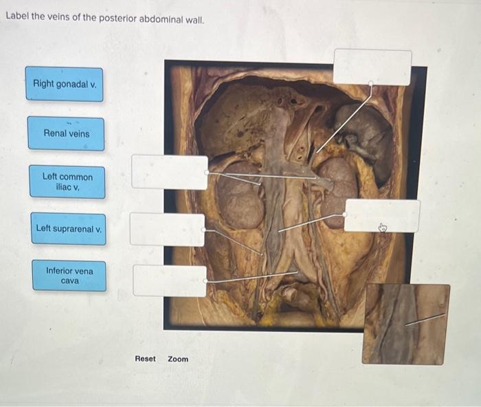 Solved Label the veins of the posterior abdominal wall. | Chegg.com