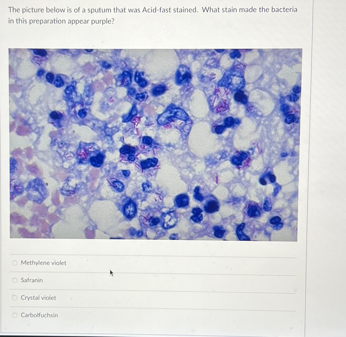 Solved The picture below is of a sputum that was Acid-fast | Chegg.com