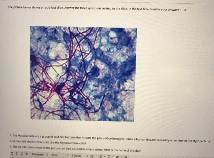 Solved The picture below shows an acid-fast slide. Answer | Chegg.com