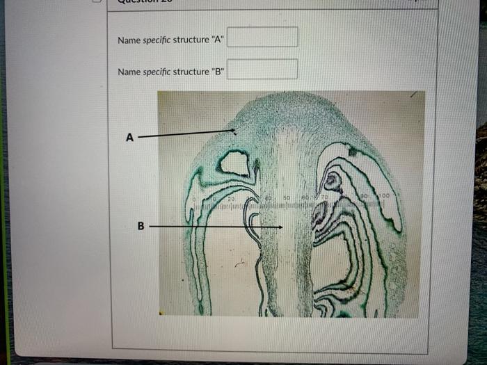 Solved Name specific structure "A" Name specific structure | Chegg.com