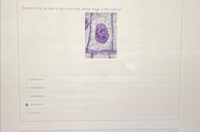 Solved Examine the picture of an onion cell. What stage is | Chegg.com
