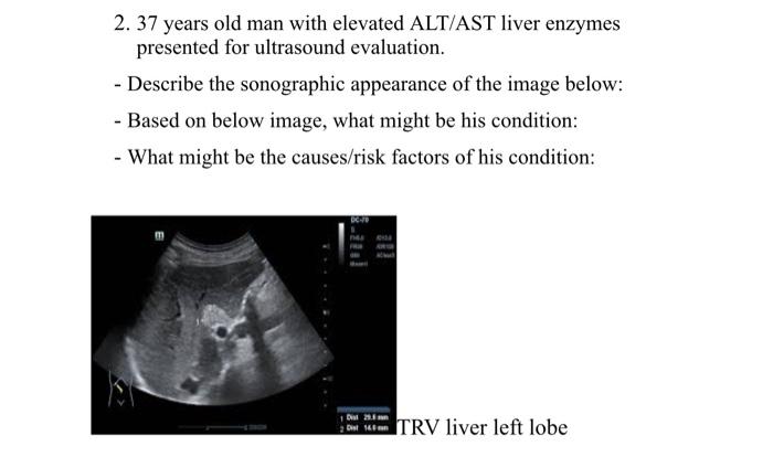 Solved 2. 37 years old man with elevated ALT/AST liver | Chegg.com