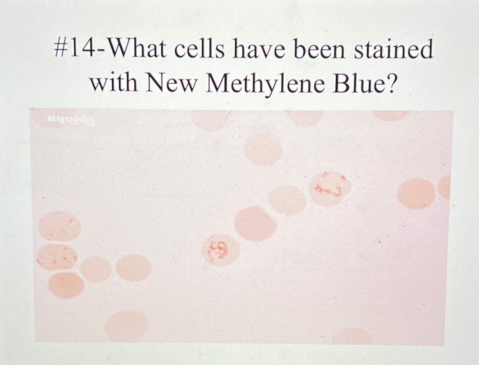 Solved #14-What cells have been stained with New Methylene | Chegg.com