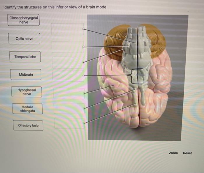 Solved Identify the structures on this inferior view of a | Chegg.com