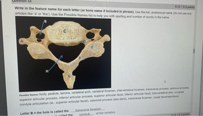 Solved Write in the feature name for each letter (or bone | Chegg.com