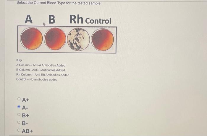 [Solved]: Select the Correct Blood Type for the tested sa