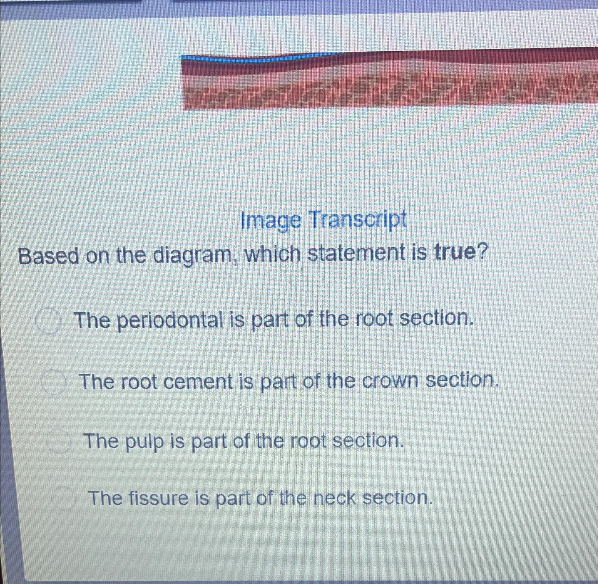 Solved Image TranscriptBased on the diagram, which statement | Chegg.com