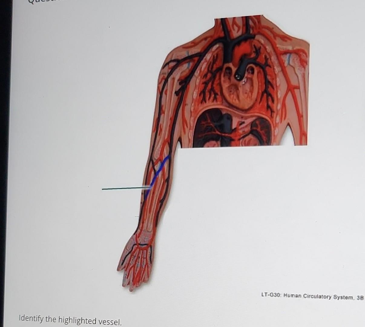 Solved Identify the highlighted vessel. | Chegg.com