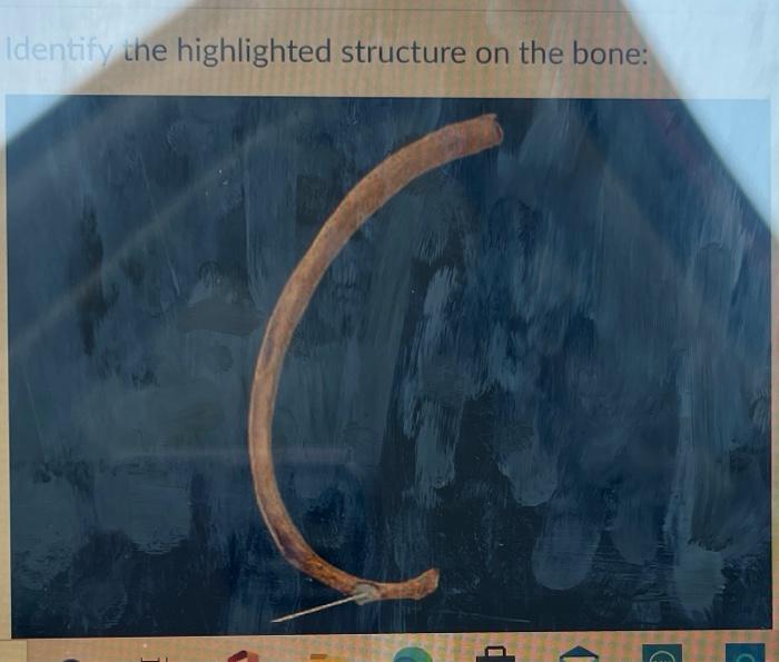 Solved Identify the highlighted structure on the bone: 1 | Chegg.com