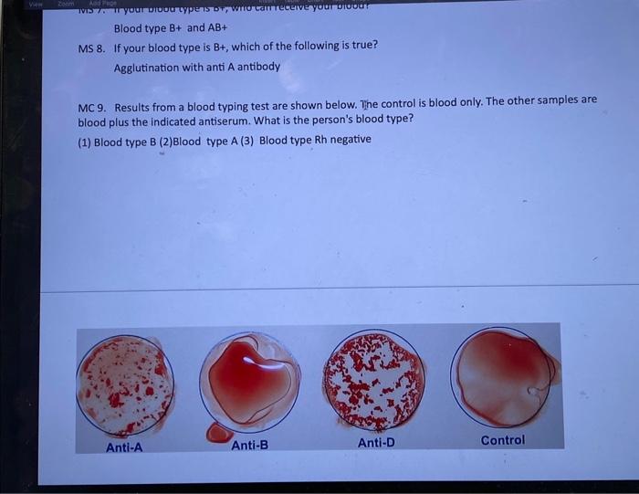 Solved Blood type B+ and AB+ MS 8. If your blood type is B+, | Chegg.com
