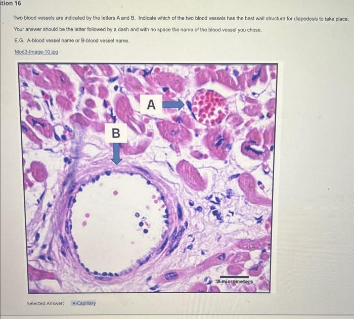 Solved Two blood vessels are indicated by the letters A and | Chegg.com