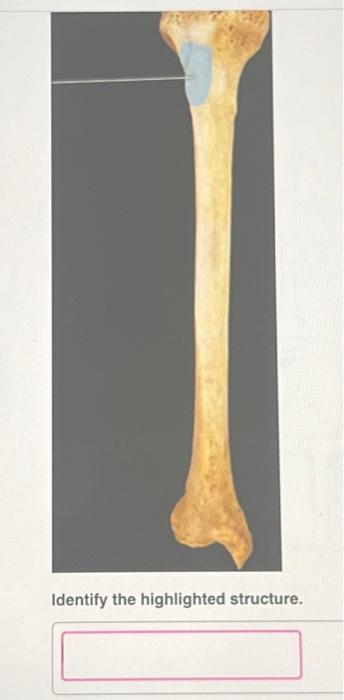 Solved The highlighted structure articulates with which | Chegg.com