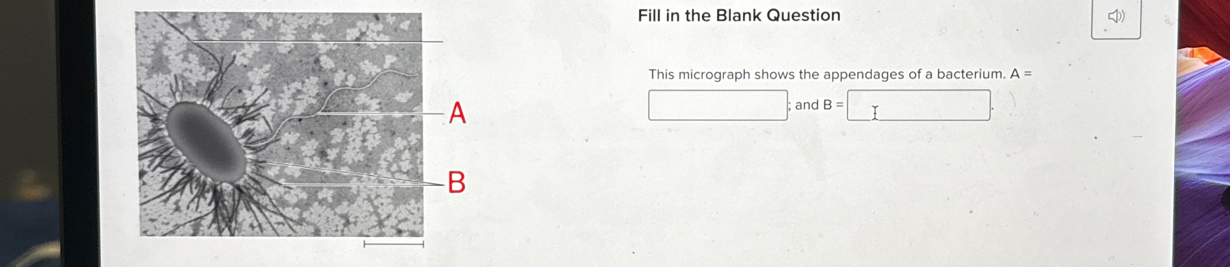 Solved Fill in the Blank QuestionThis micrograph shows the | Chegg.com
