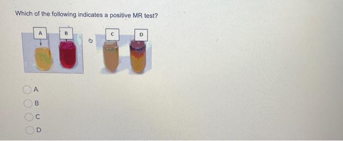 Solved Which of the following indicates a positive MR test? | Chegg.com