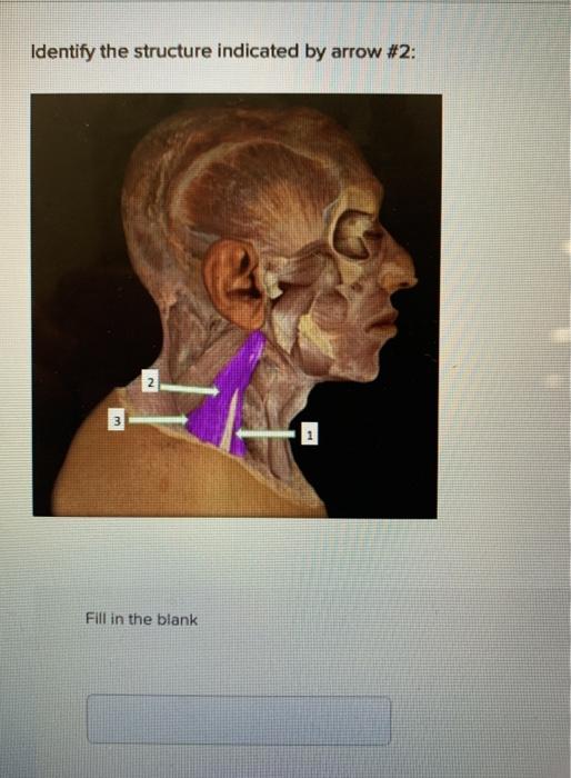 Solved Identify the structure indicated by arrow #2: 2 3 1 | Chegg.com