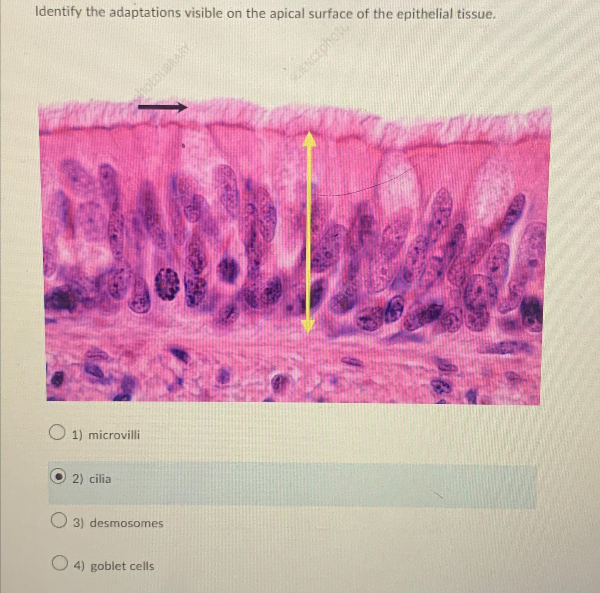 Solved Identify the adaptations visible on the apical | Chegg.com