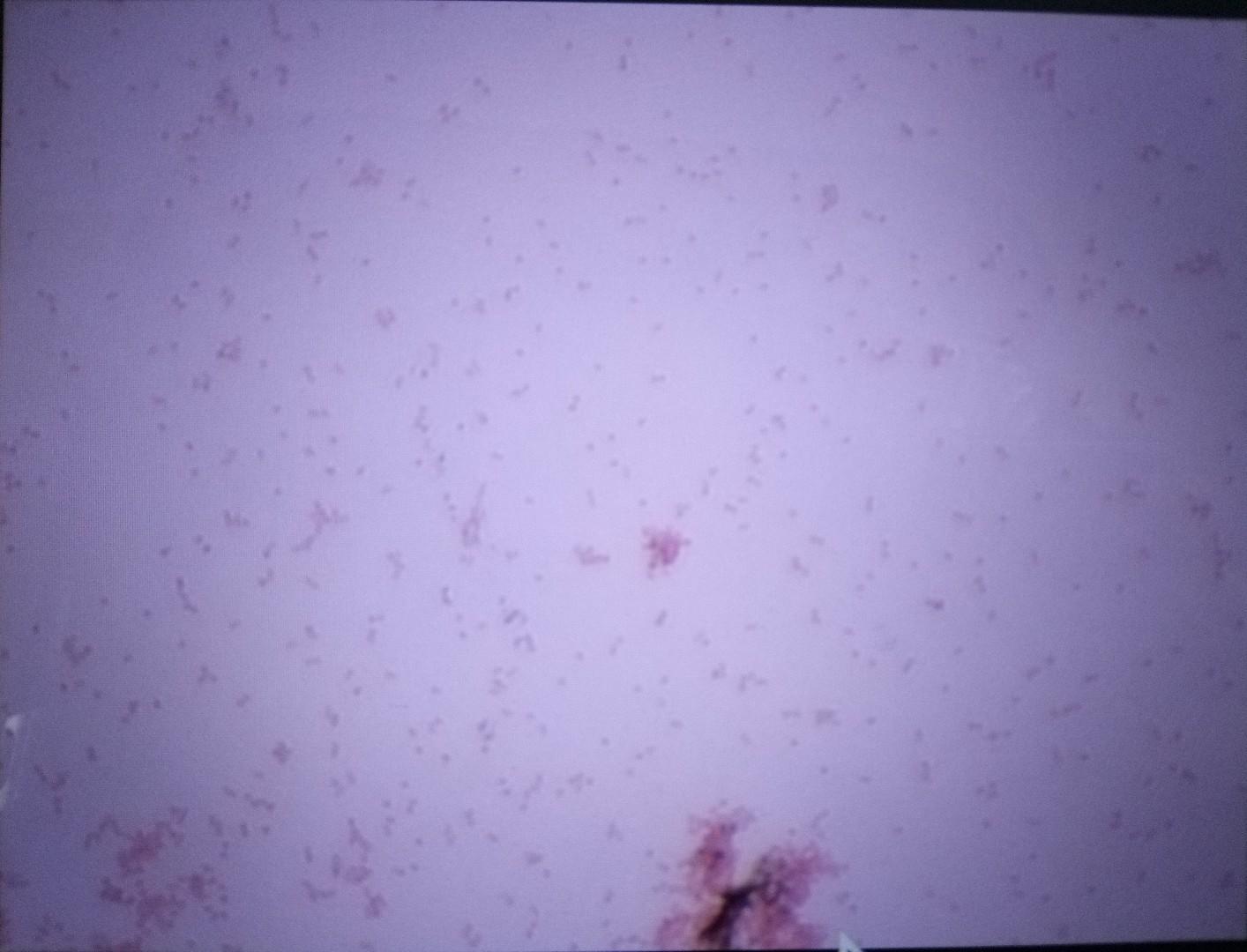 Solved Alcaligenes viscolactis Bacillus | Chegg.com