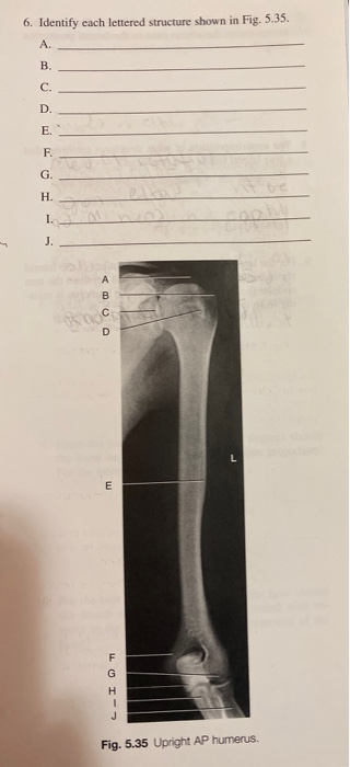 Solved 6. Identify each lettered structure shown in Fig. | Chegg.com
