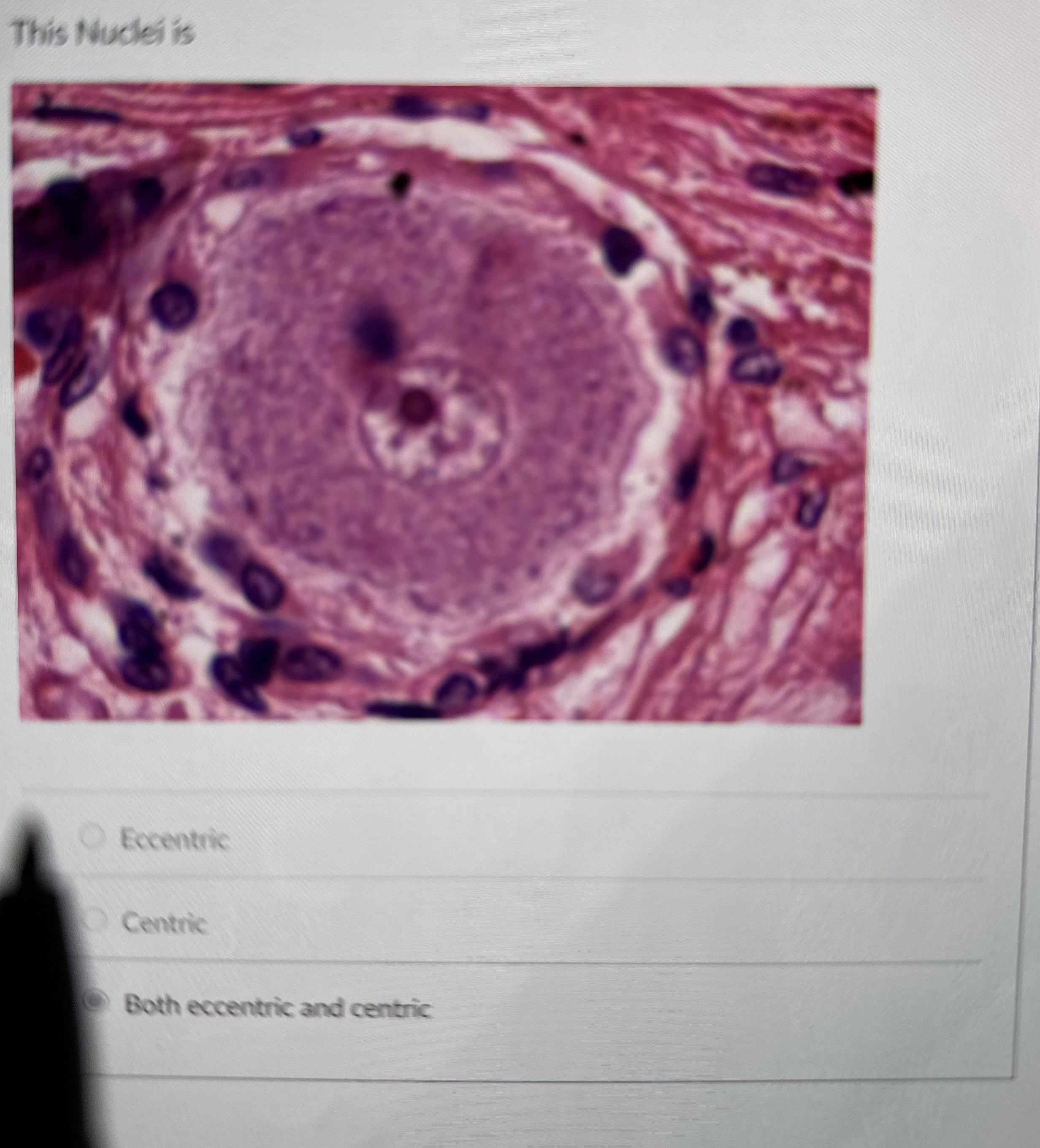Solved This Nuclei isEccentricCentricBoth eccentric and | Chegg.com