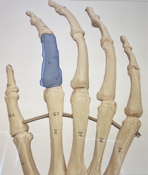 Solved Lunate Capitate Scaphoid Trapezoid Trapezium | Chegg.com