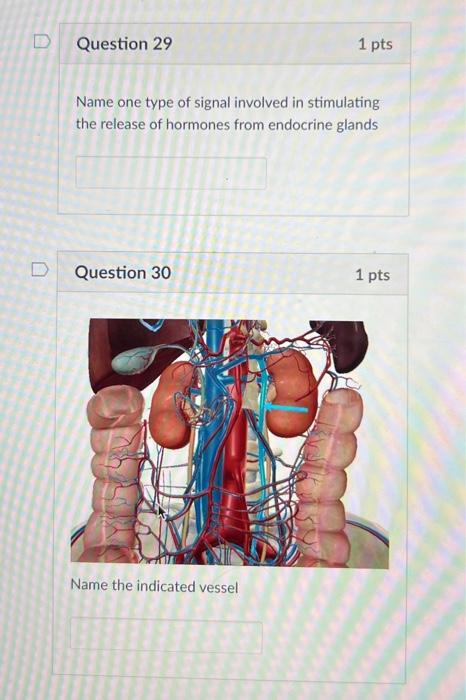 Solved Question 27 Name the indicated vessel Name the | Chegg.com
