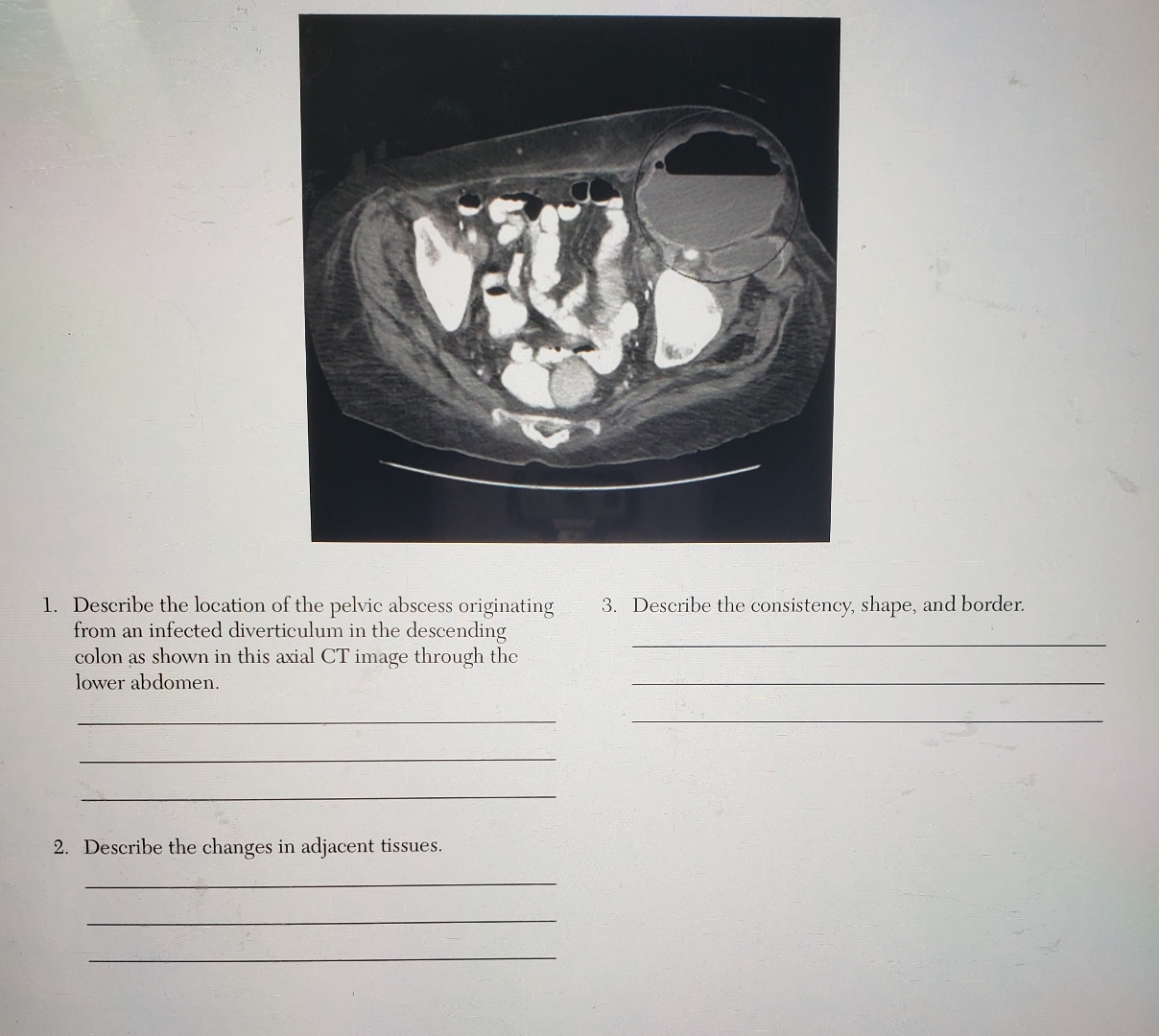 Solved Describe the location of the pelvic abscess | Chegg.com