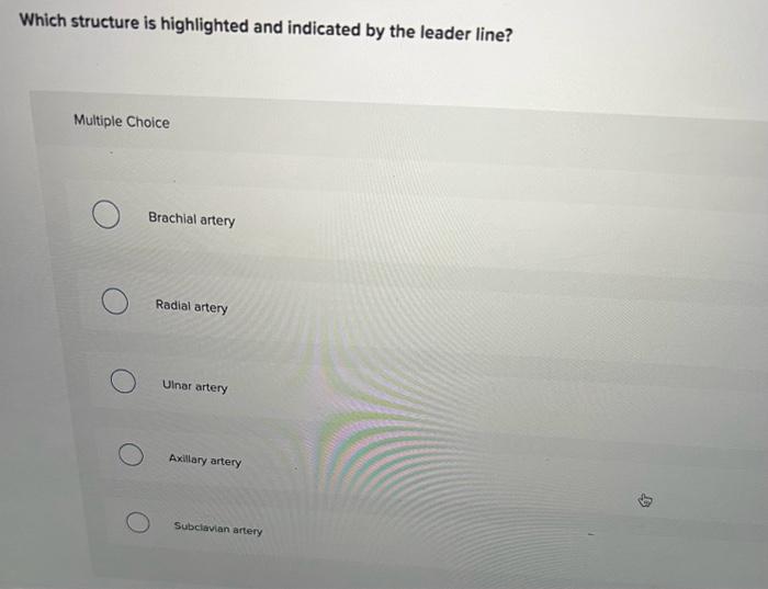 Which structure is highlighted and indicated by the | Chegg.com