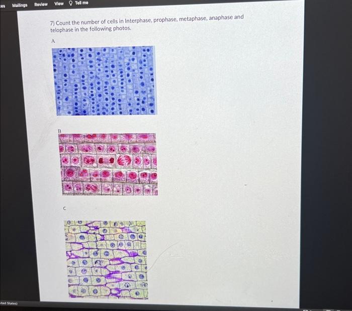 Solved 7) Count the number of cells in Interphase, prophase, | Chegg.com