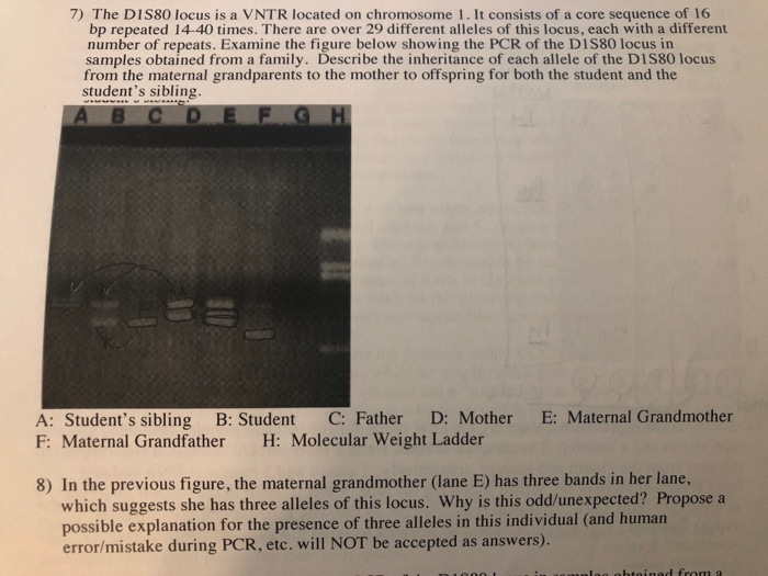 Solved 7) The DIS80 locus is a VNTR located on chromosome 1. | Chegg.com