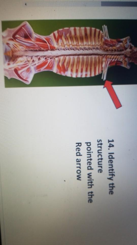 Solved 9. Identify the structure pointed with the Red arrow | Chegg.com