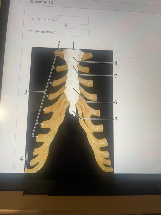 Solved Identify muscle of (R or L) Identify muscle 10 (R or | Chegg.com Solved Identify muscle of (R or L) Identify muscle 10 (R or | Chegg.com
