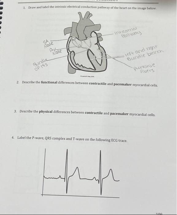 1. Draw and label the intrinsic electrical conduction | Chegg.com