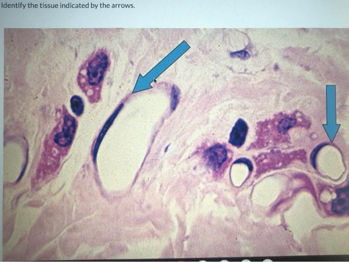 Solved Identify the fiber at the tip of the pointer.. | Chegg.com