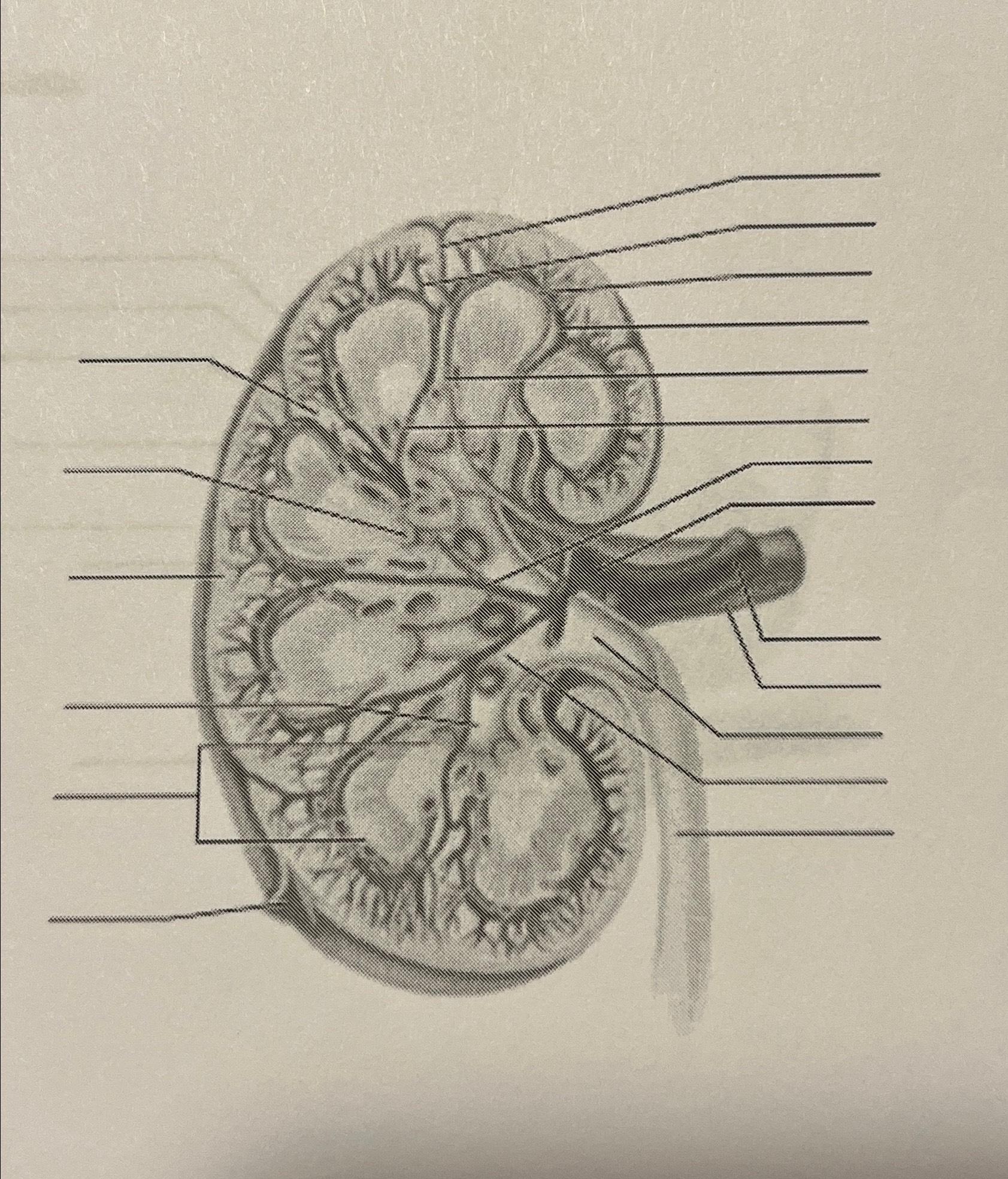 Solved Label veins and arteries of kidney | Chegg.com